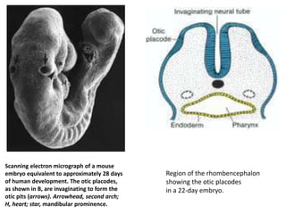 Embryology 18 ear | PPTX