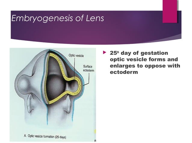 Embryology and anatomy of human lens | PPT | Eye and Vision Conditions ...