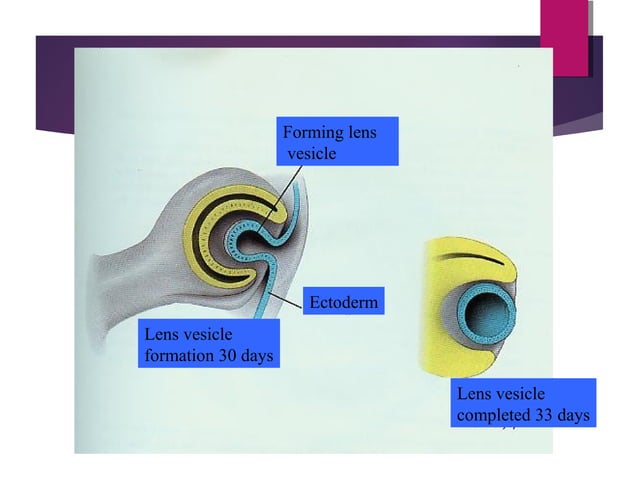 Embryology and anatomy of human lens | PPT | Eye and Vision Conditions ...