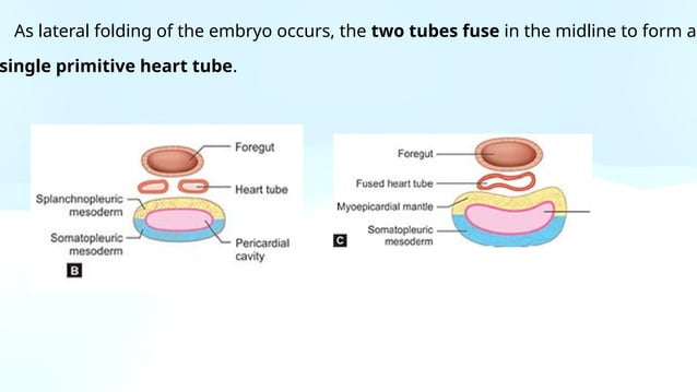embryology and radiological anatomy of heart copy 2.pptx