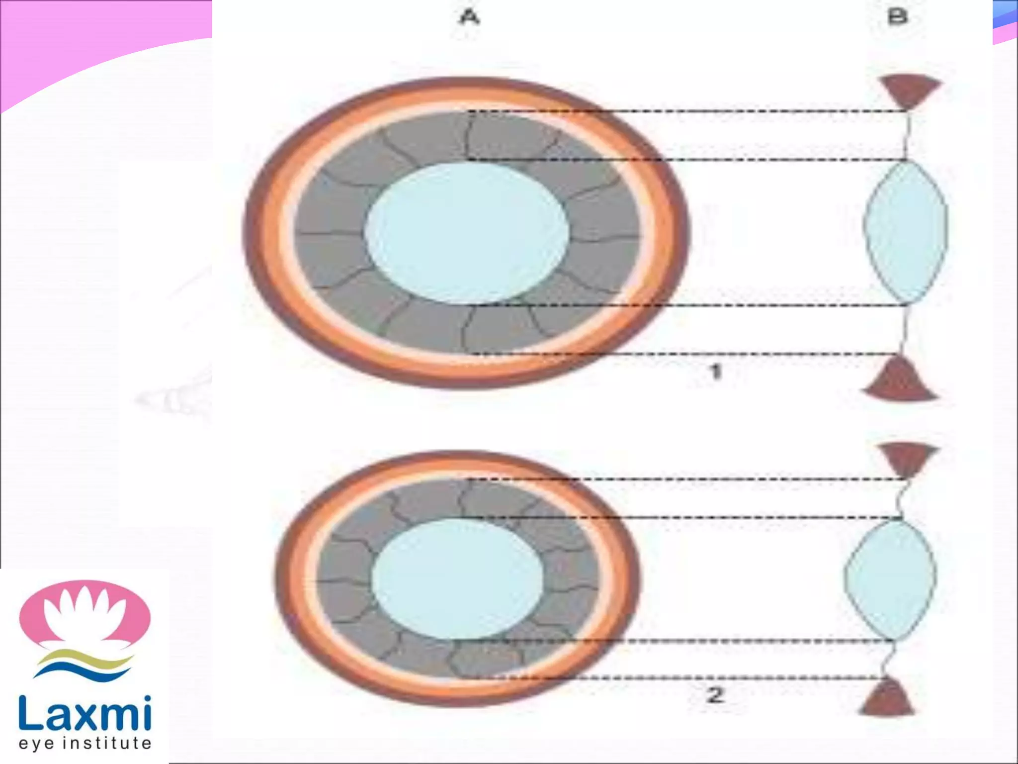 Embryology applied anatomy and physiology of lens | PPTX