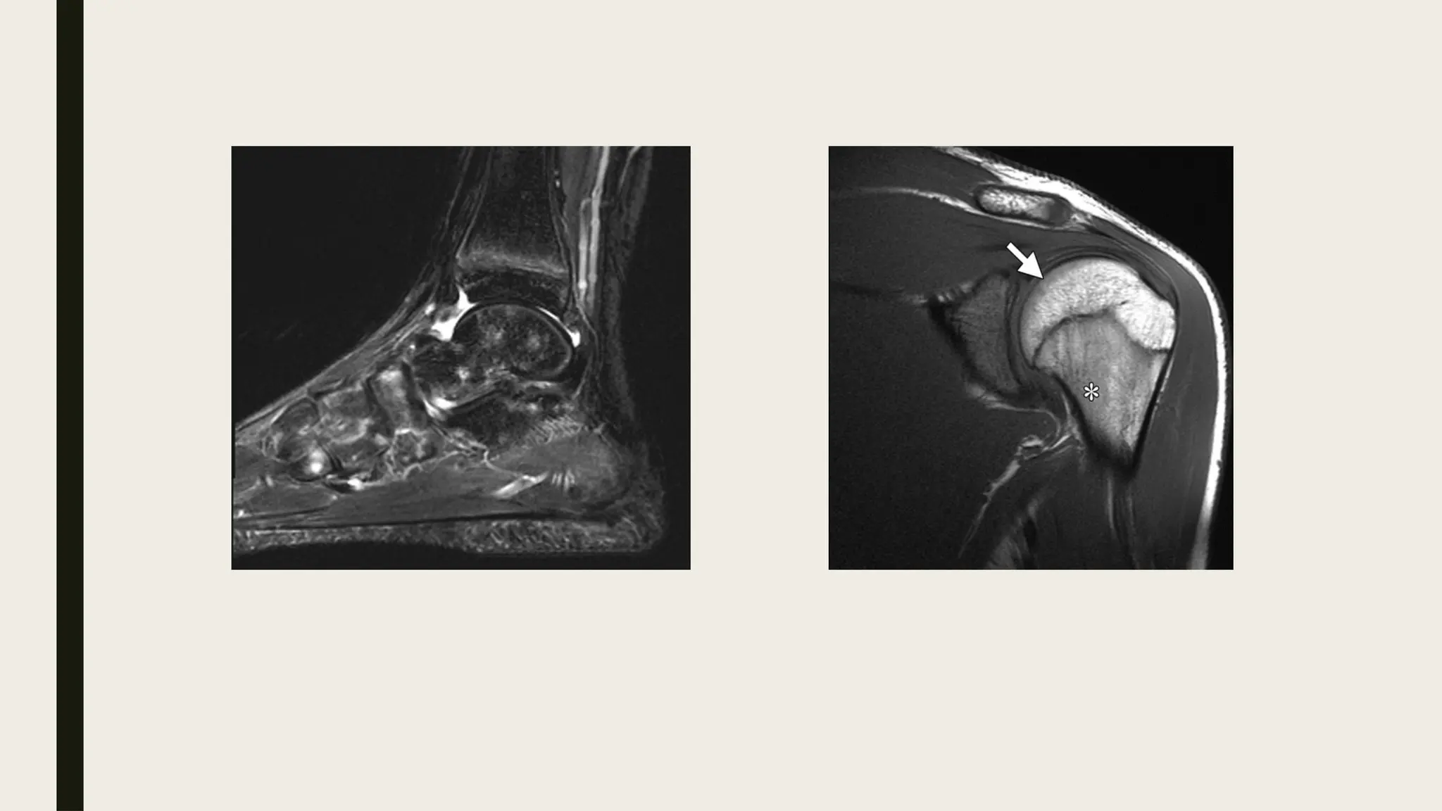 Bone formation and growth, embryology and growth | PPTX