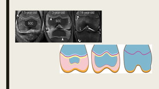 Bone formation and growth, embryology and growth | PPTX