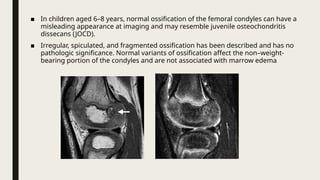 Bone formation and growth, embryology and growth | PPTX