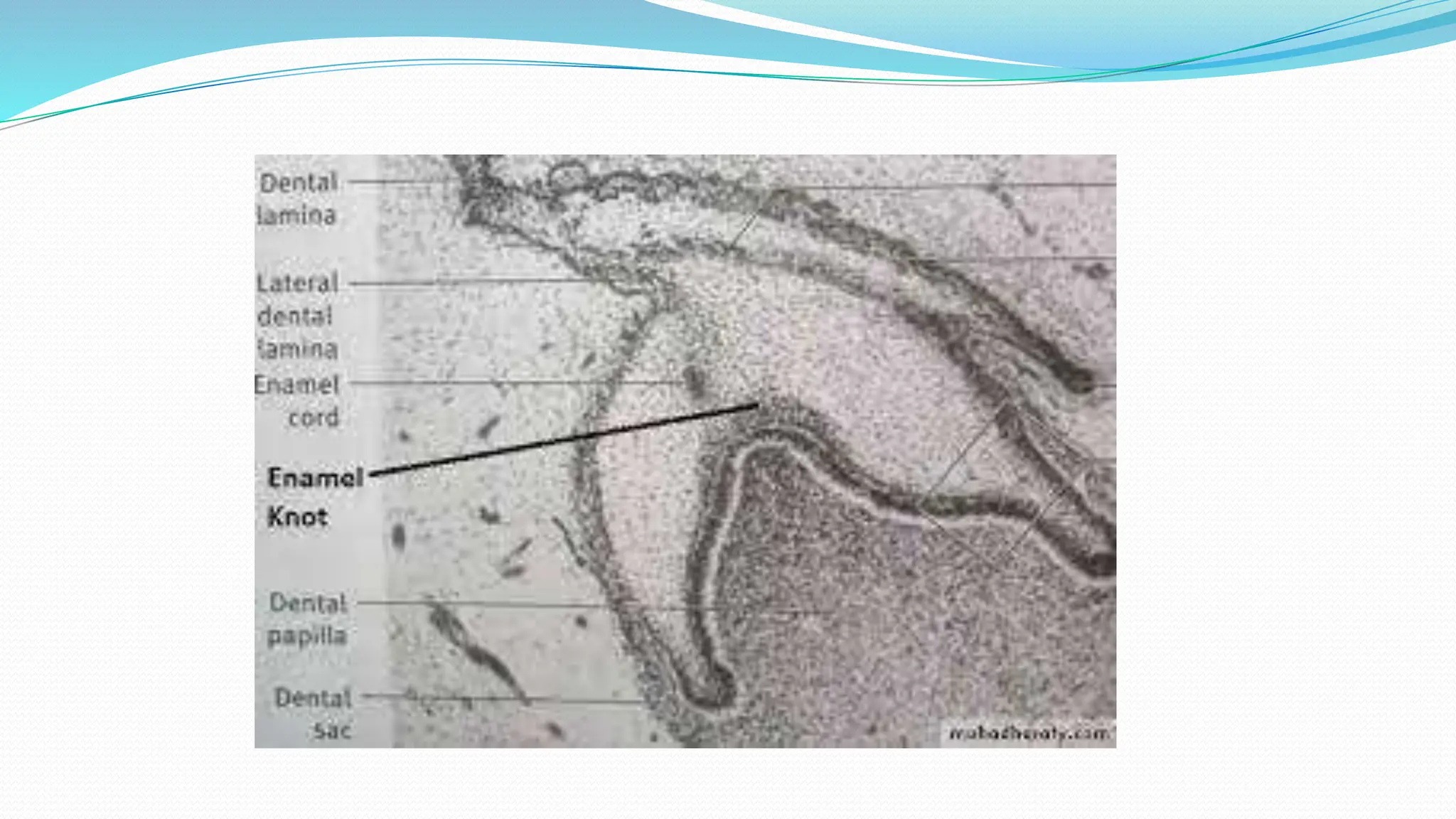 Embryology Dental and associated syndromes | PPTX