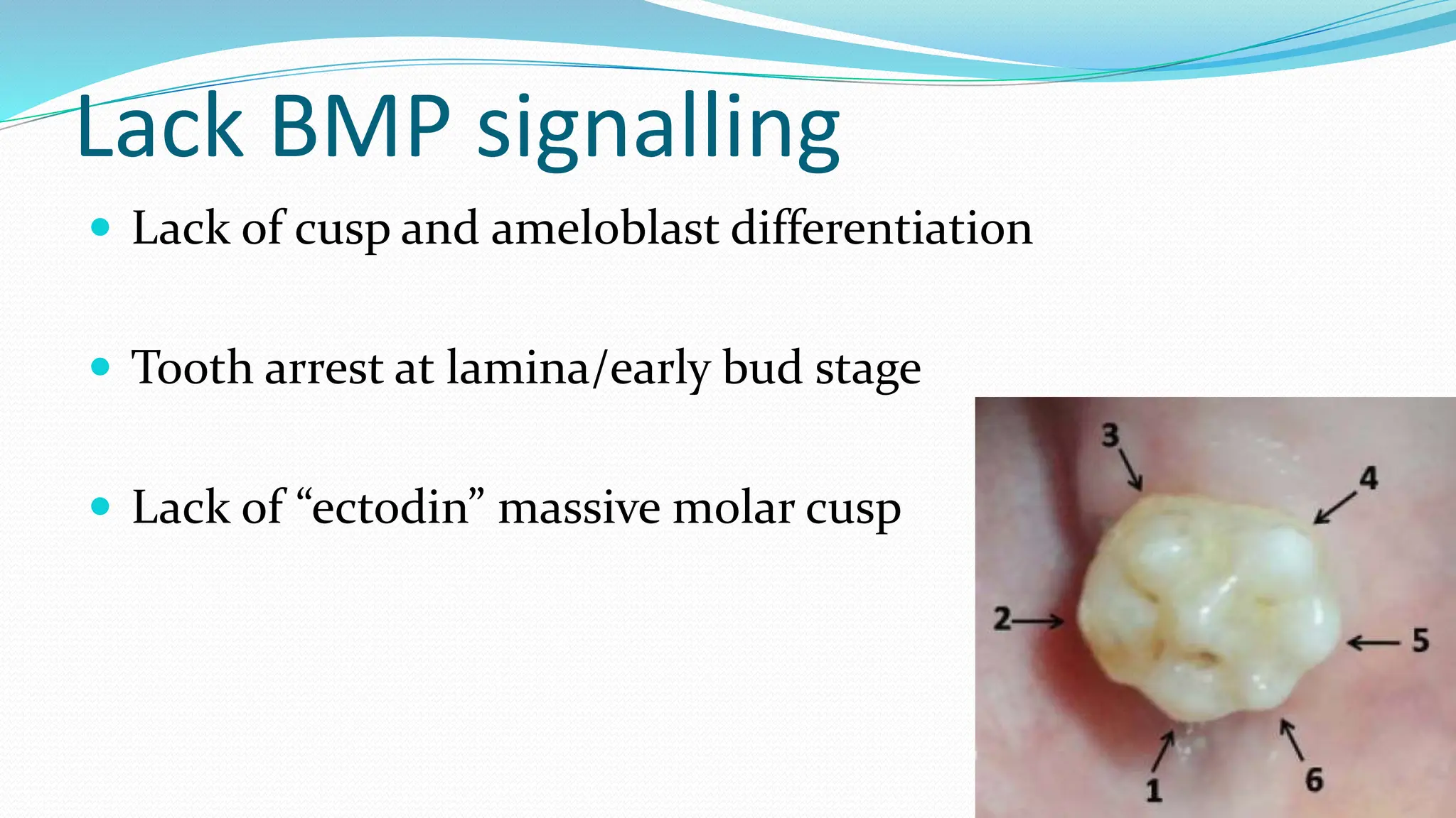 Embryology Dental and associated syndromes | PPTX