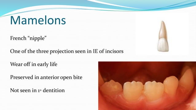 Embryology Dental and associated syndromes | PPT