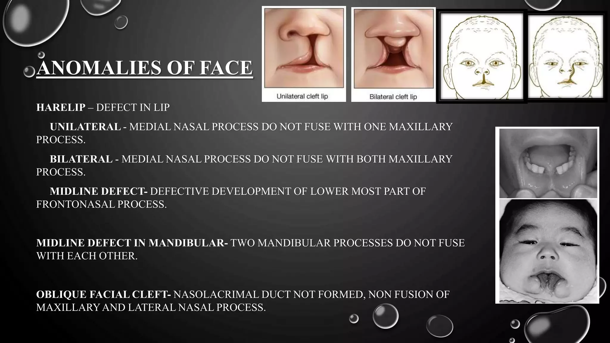 Embryology in orthodontics | PPTX