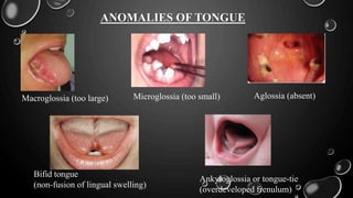 Embryology in orthodontics | PPTX