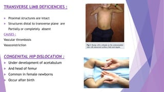 Embryology limb defects | PPTX