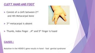 Embryology limb defects | PPTX