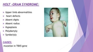 Congenital Limb Deficiency
