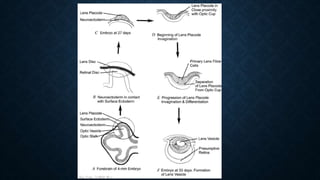 Embryology of angle of anterior chamber | PPTX
