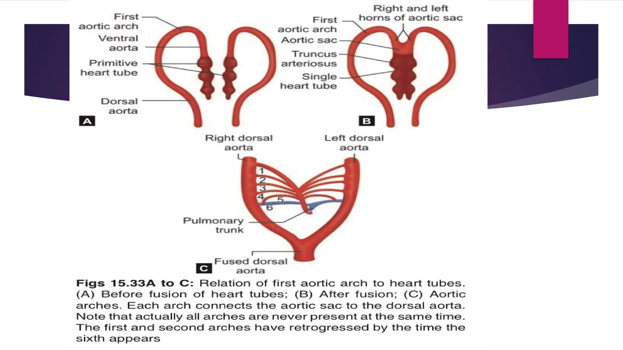 embryology and anatomy of aortic arch .pptx