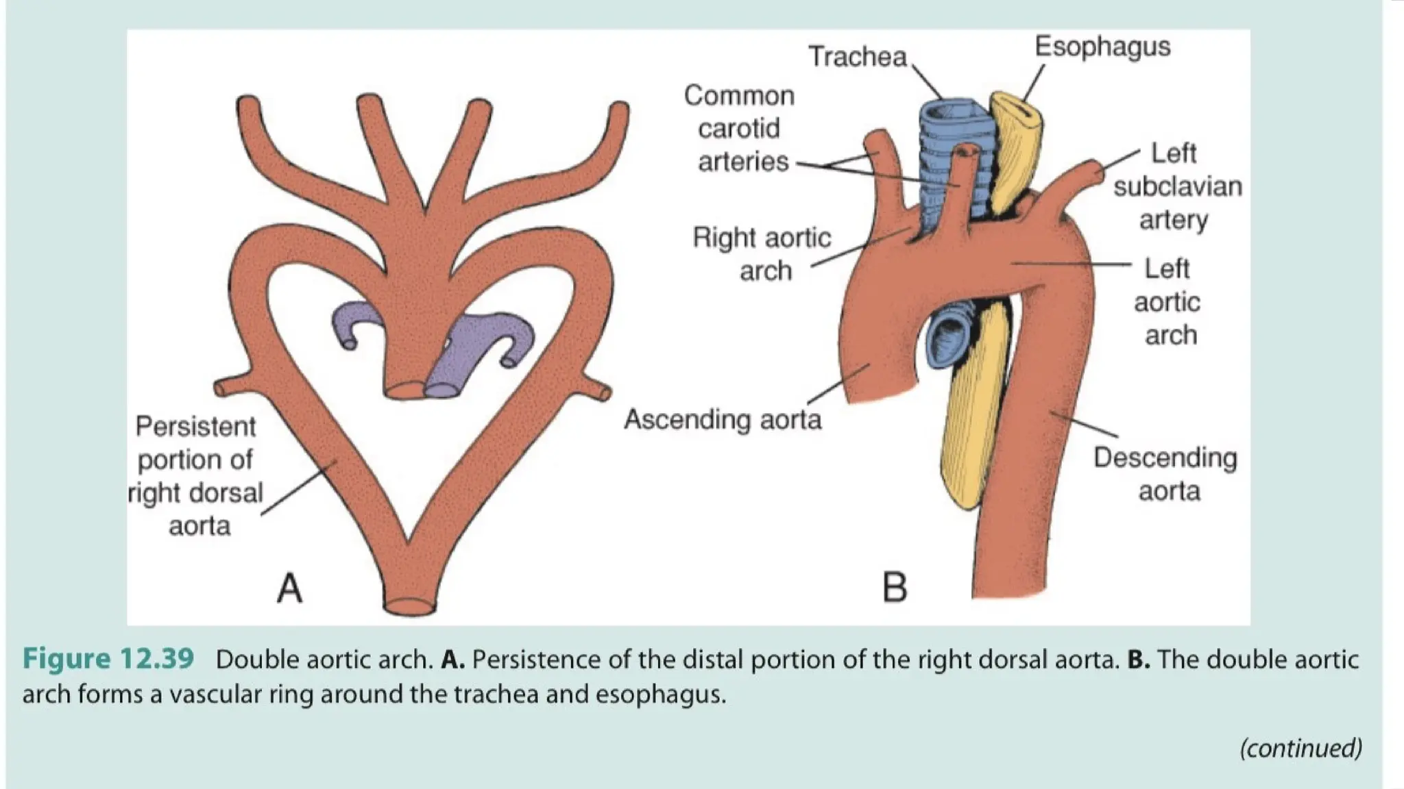 embryology and anatomy of aortic arch .pptx