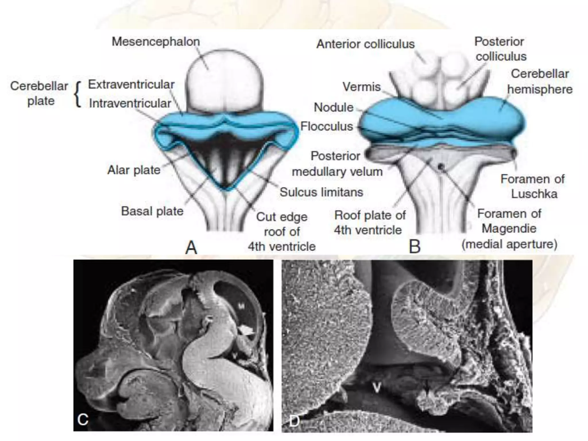 Embryology of brain | PPTX