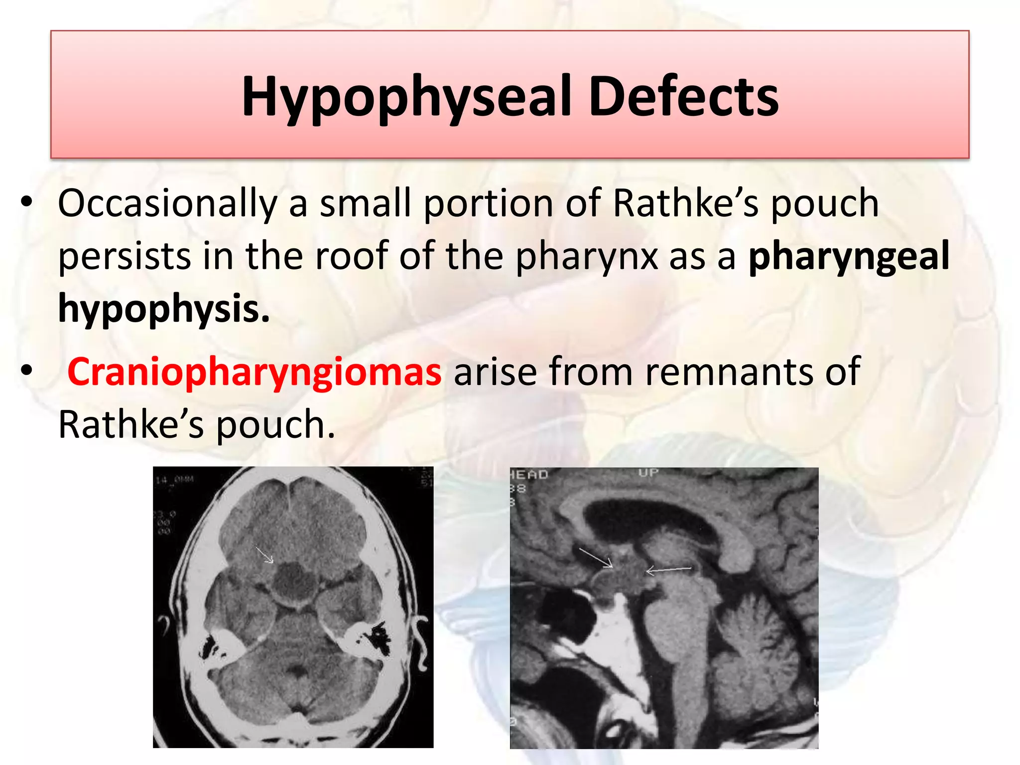 Embryology of brain | PPTX