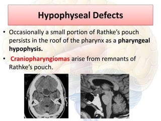 Embryology of brain | PPTX