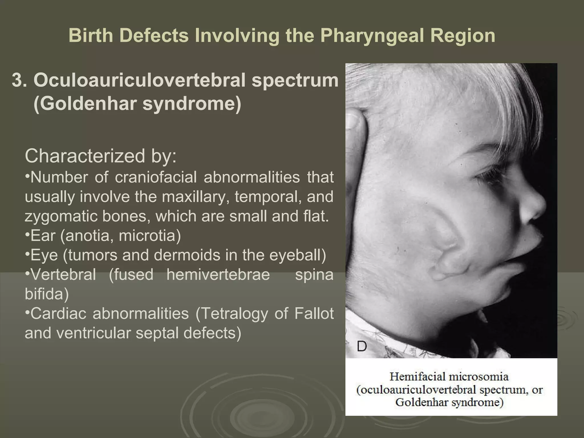 Embryology of branchial arches applied anatomy by osama elhamzawy | PPT