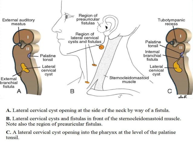 Embryology of branchial arches applied anatomy by osama elhamzawy | PPT