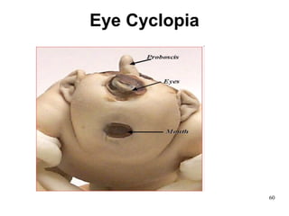Embryology of the Central Nevous system and anomalies | PPT
