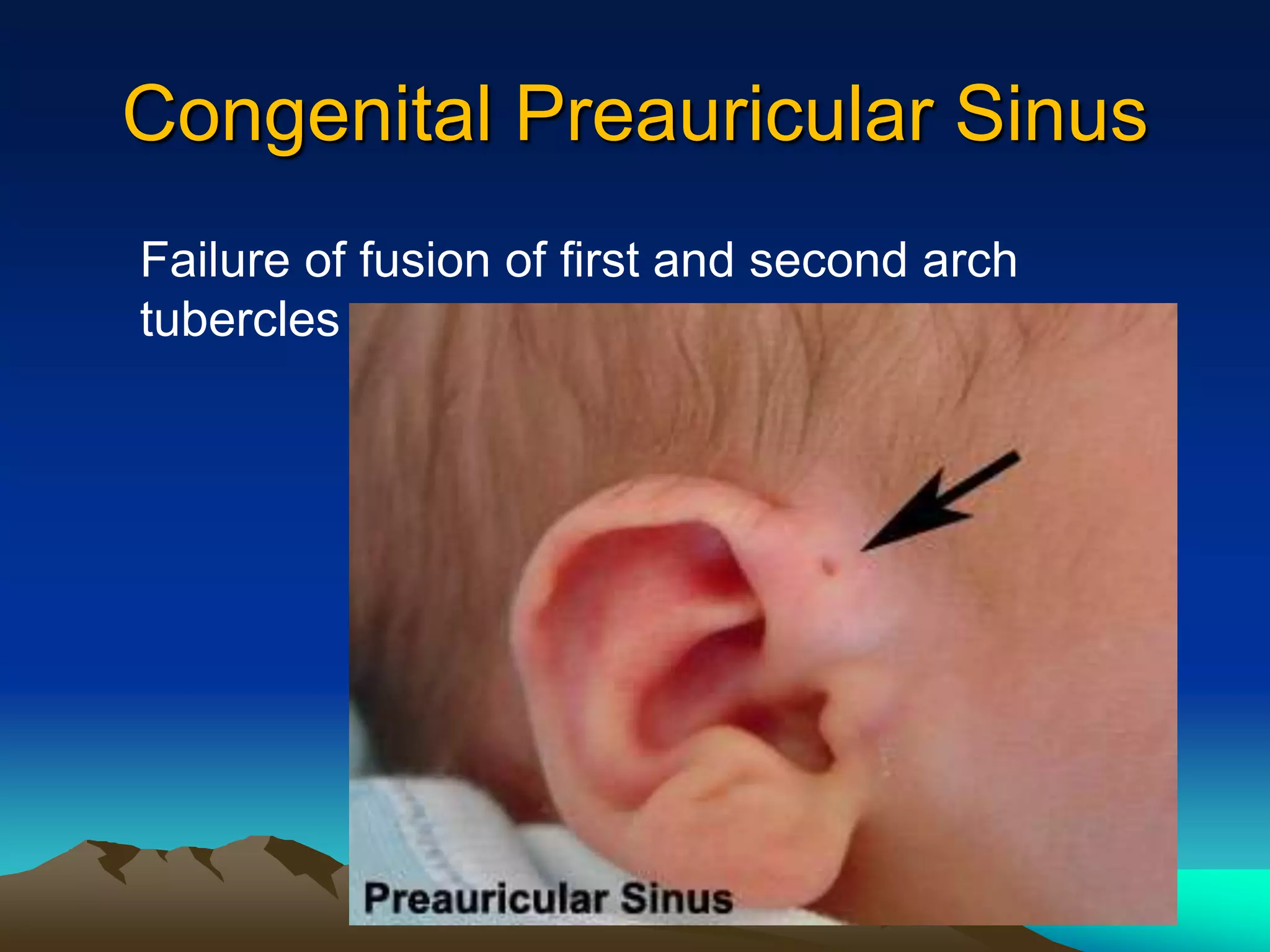 Embryology of ear8 | PPTX