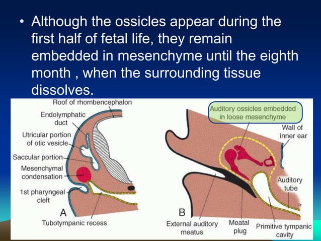 Embryology of ear8 | PPTX | Ear, Nose and Throat Conditions | Diseases ...