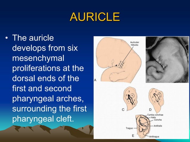 Embryology of ear8 | PPTX | Ear, Nose and Throat Conditions | Diseases ...