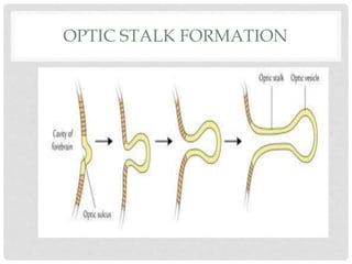 Embryology of Eye.pptx