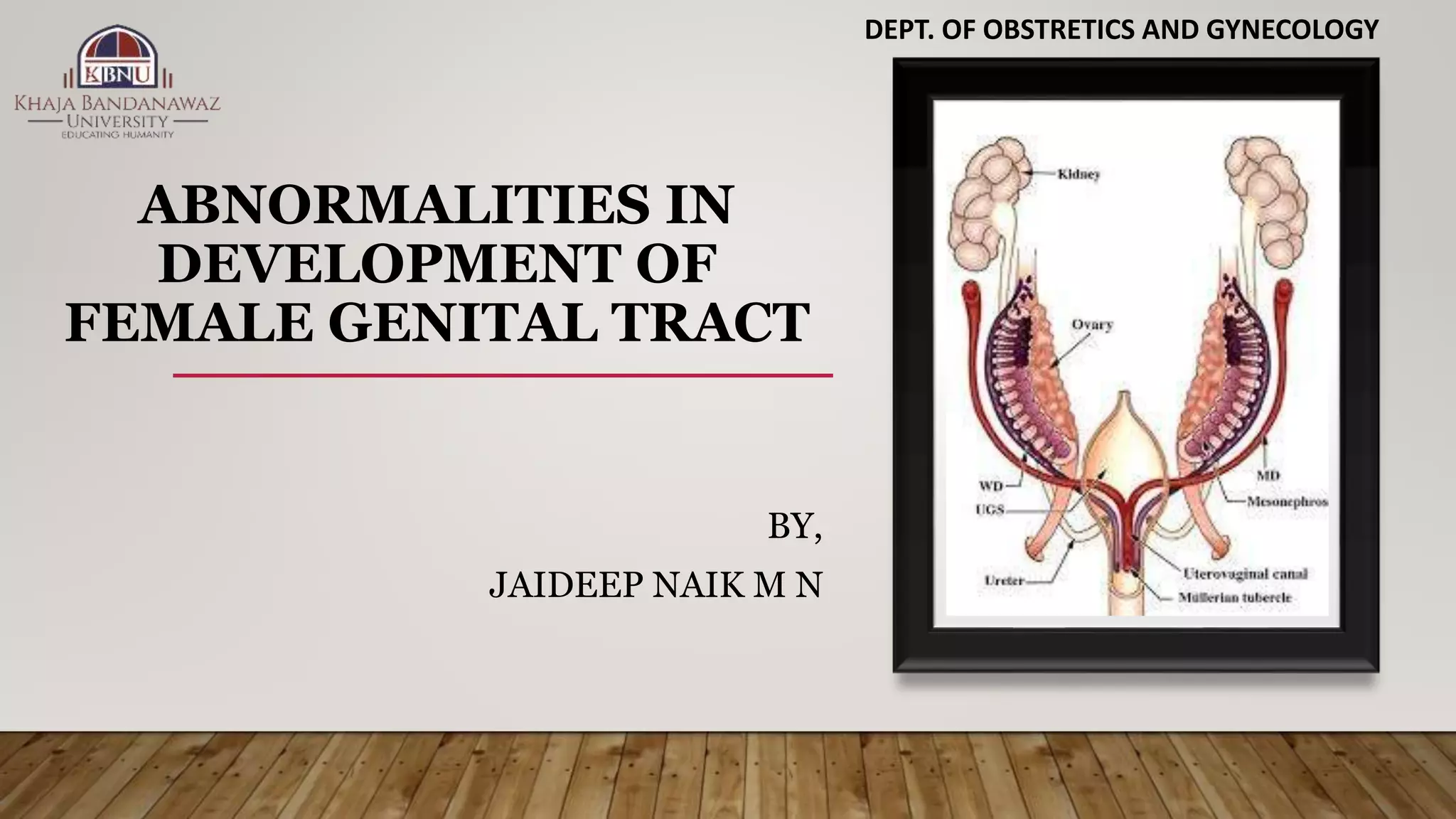 ABNORMALITIES IN DEVELOPMENT OF FEMALE GENITALIA | PPTX