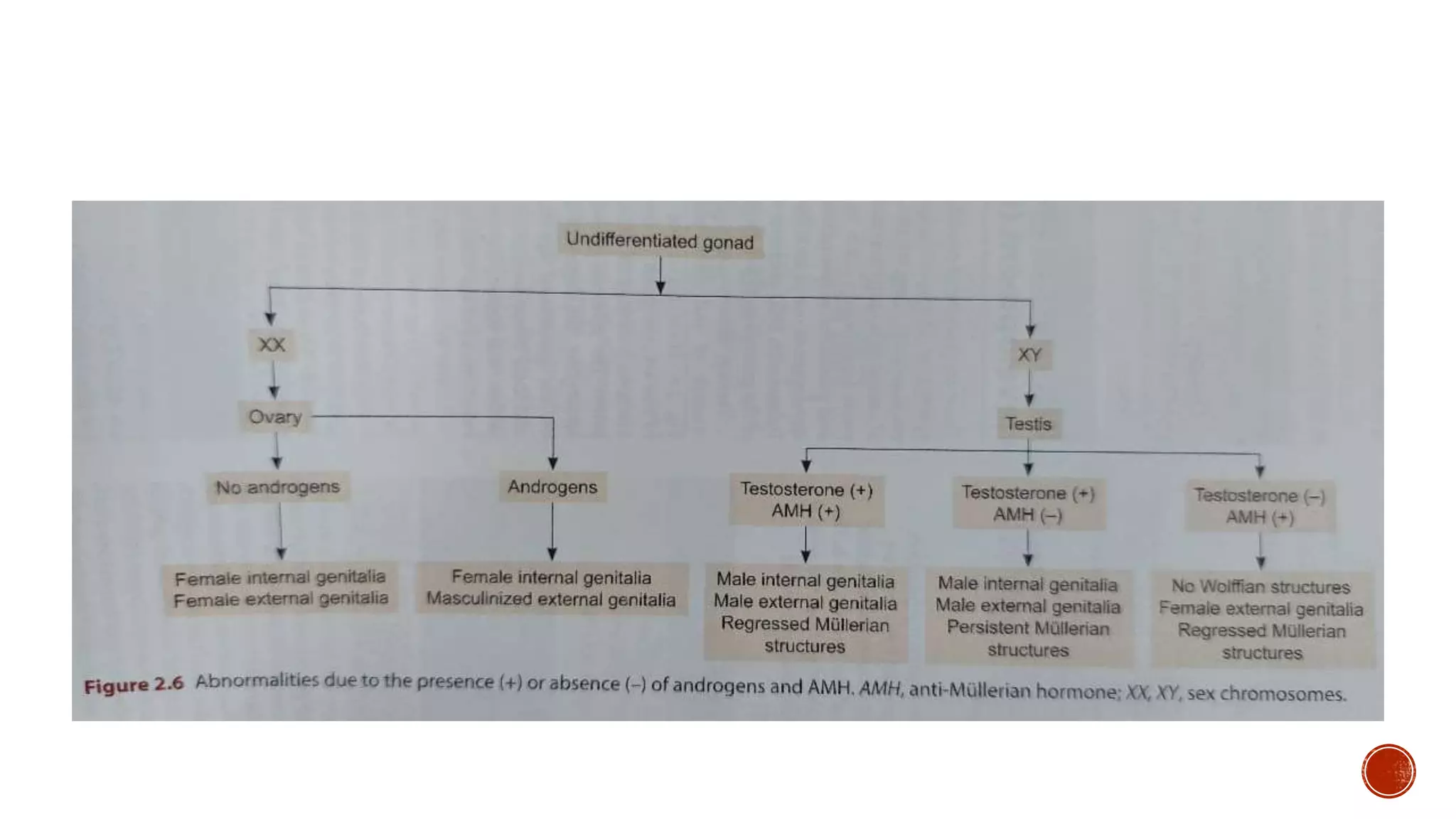 ABNORMALITIES IN DEVELOPMENT OF FEMALE GENITALIA | PPTX