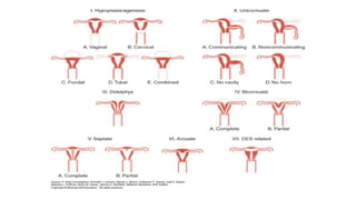 Embryology of genitourinary system | PPTX