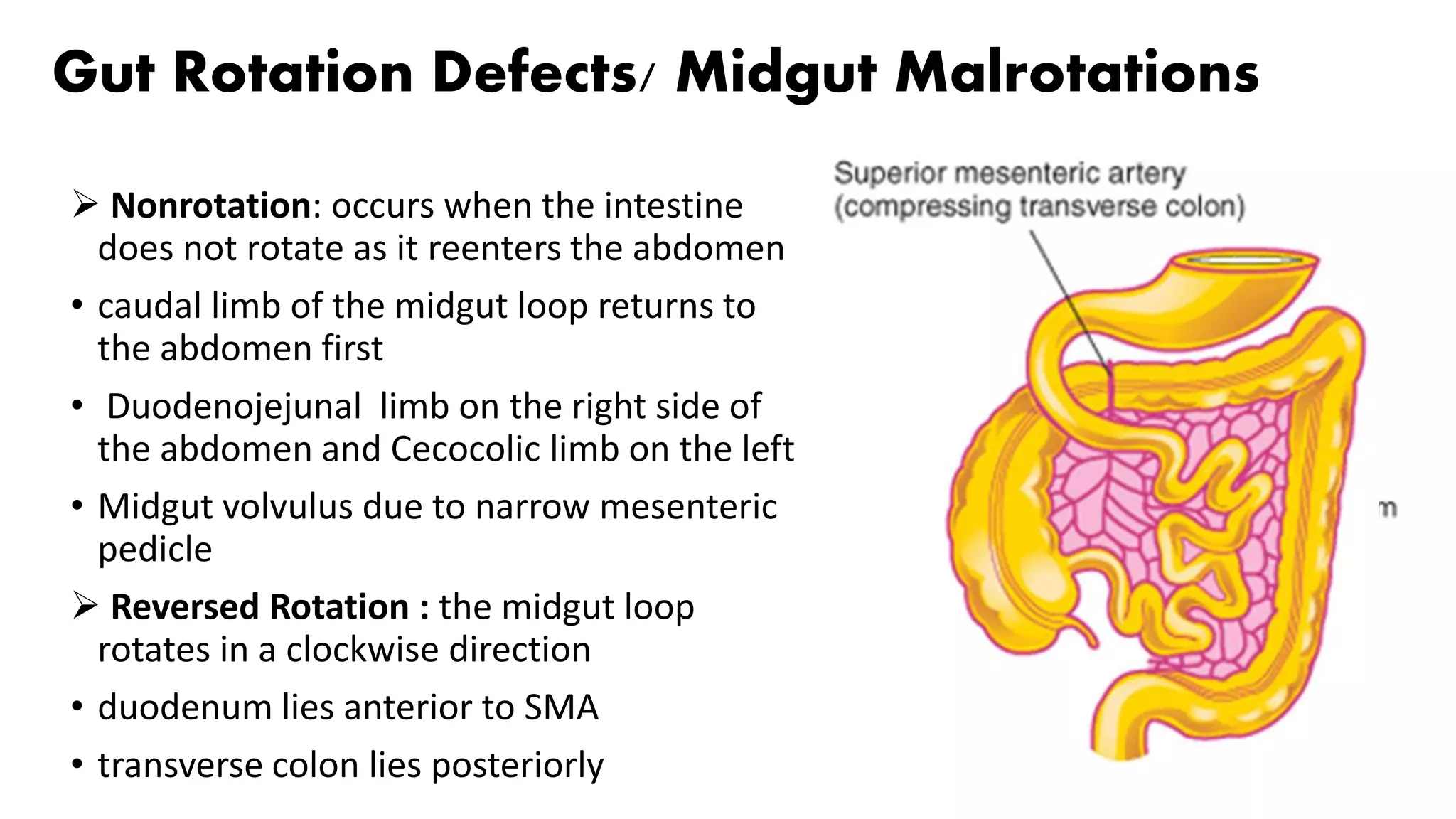 Embryology of GIT malformations by Dr. Yeneneh | PPTX