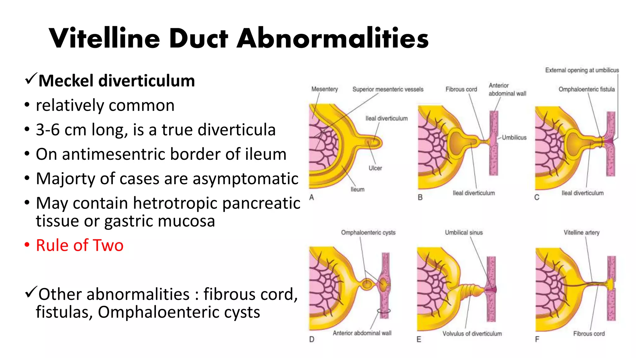 Embryology of GIT malformations by Dr. Yeneneh | PPTX