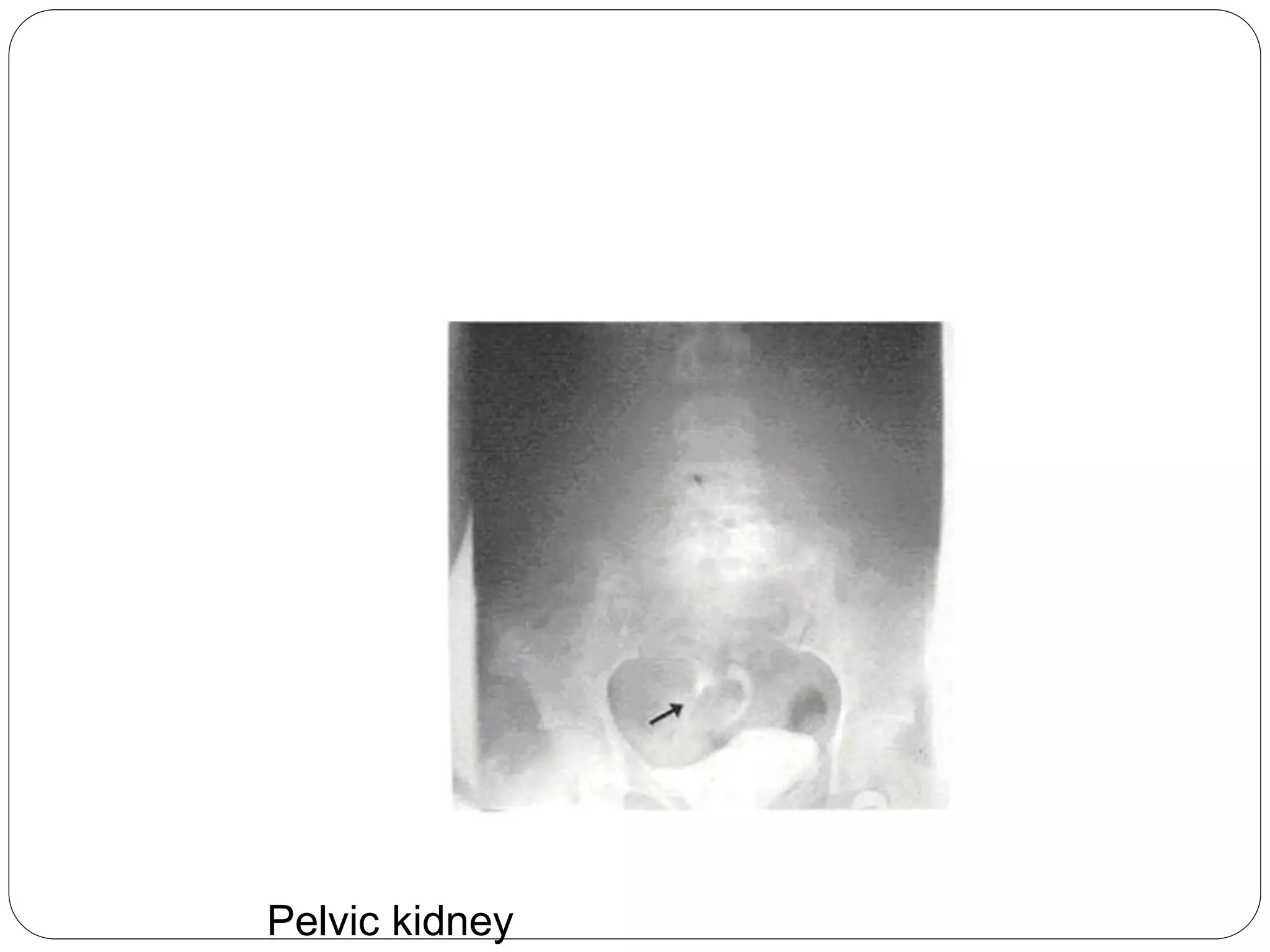 Embryology of genitourinary system | PPT