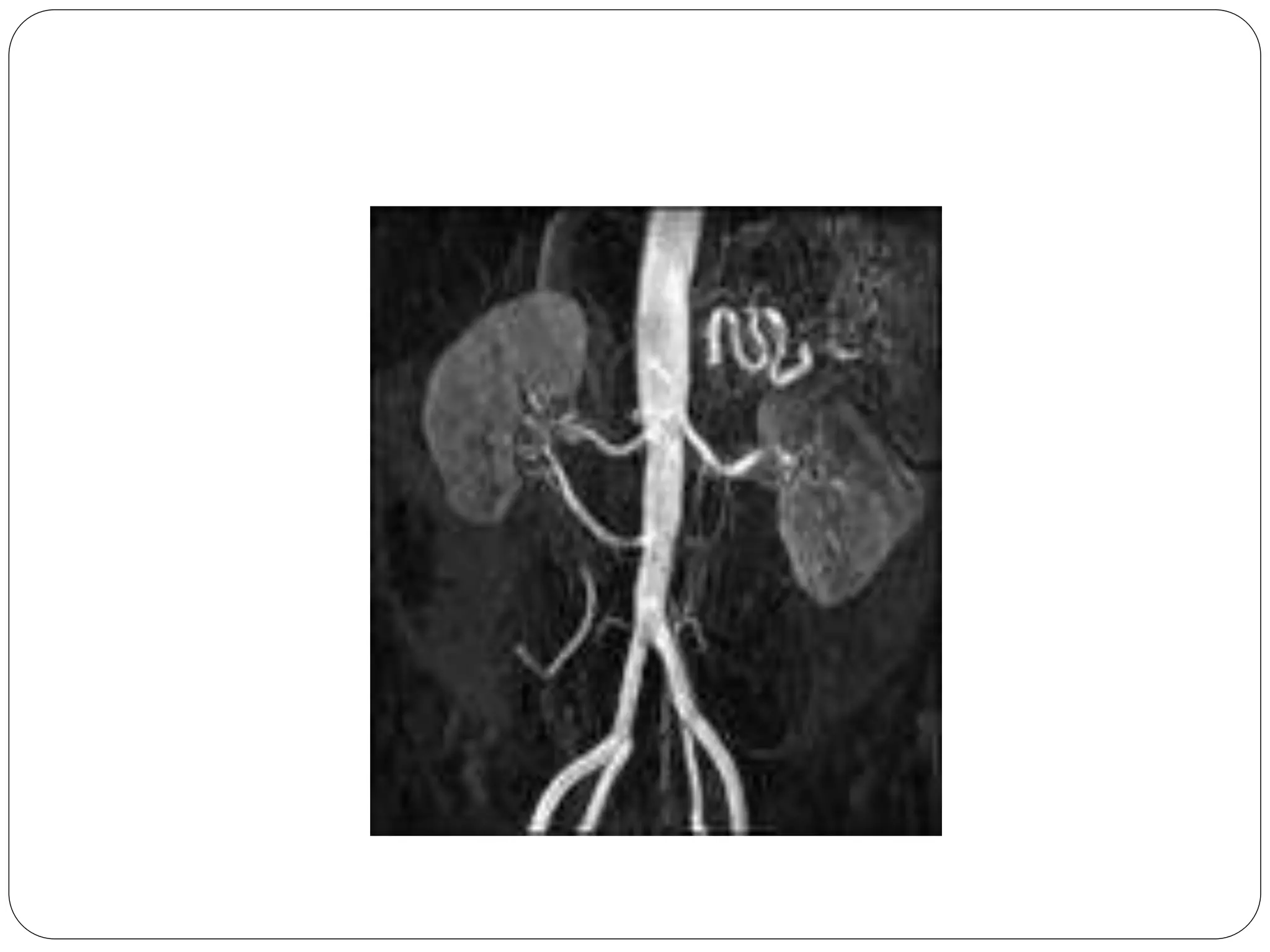 Embryology of genitourinary system | PPT