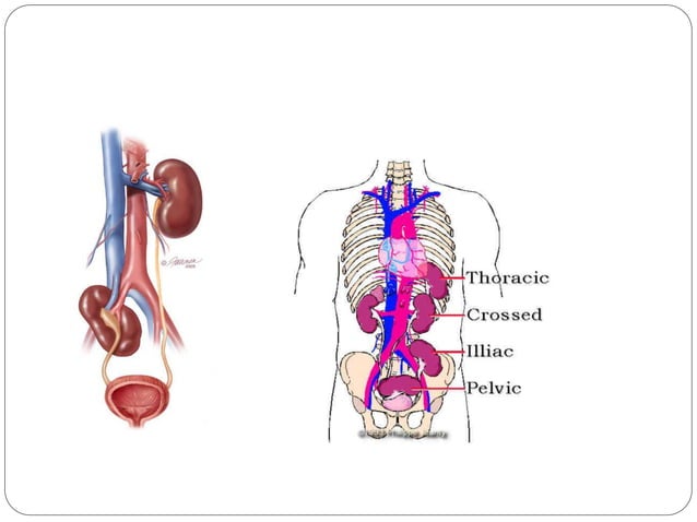 Embryology of genitourinary system | PPT
