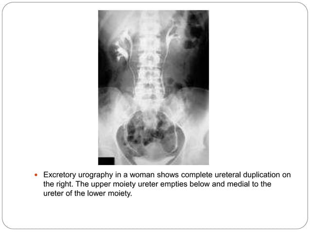 Embryology of genitourinary system | PPT