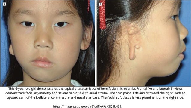 "Embryology of the Head and Neck: Key Concepts for Dental Students ...
