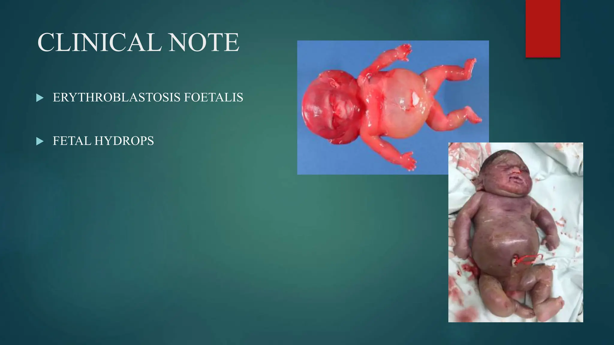 Embryology of head and neck - arun omfspptx | PPTX