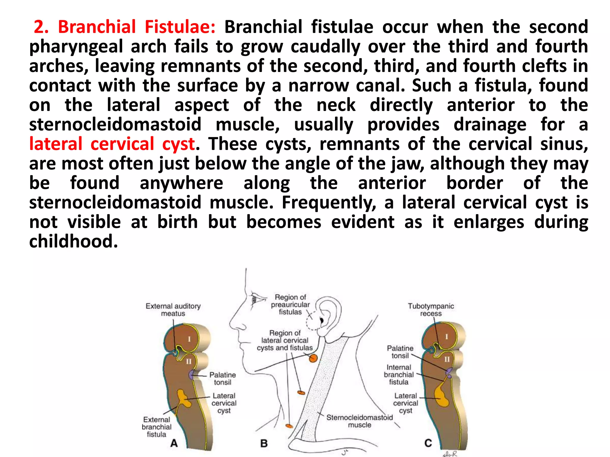 Embryology of head&neck es - copy | PPTX | Ear, Nose and Throat ...