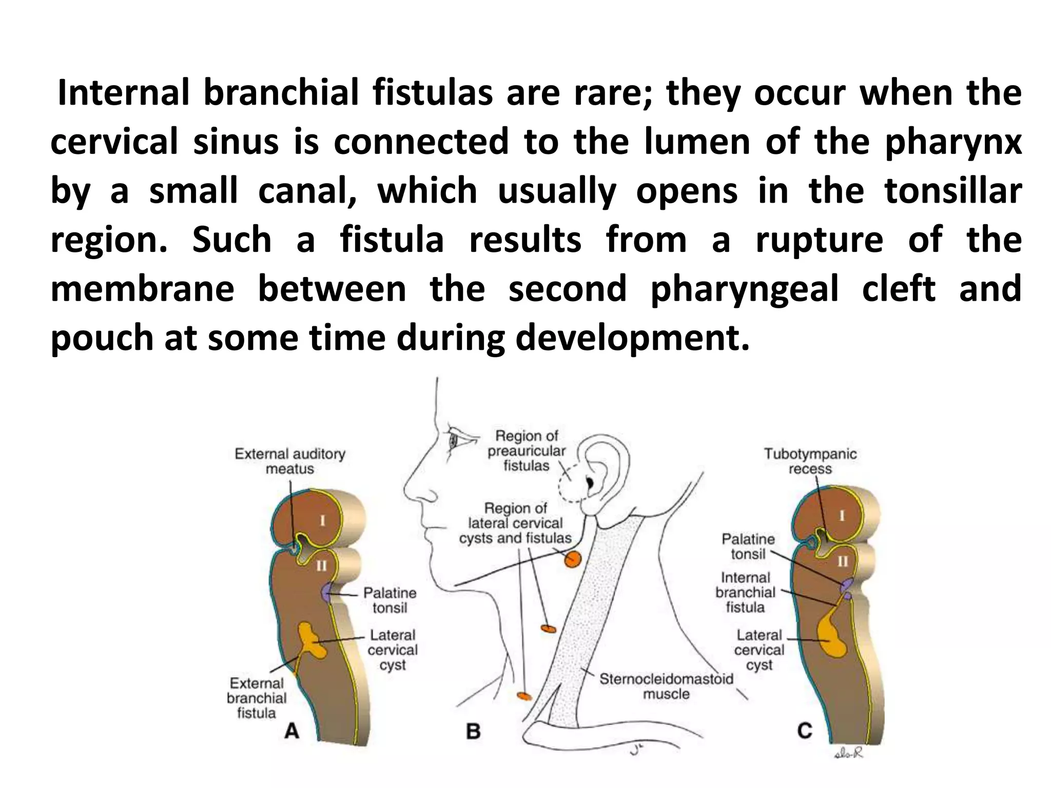 Embryology of head&neck es - copy | PPTX | Ear, Nose and Throat ...