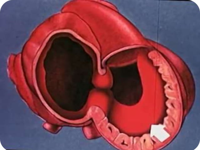 Embryology of heart and fetal circulation | PPTX | Lung and Respiratory ...