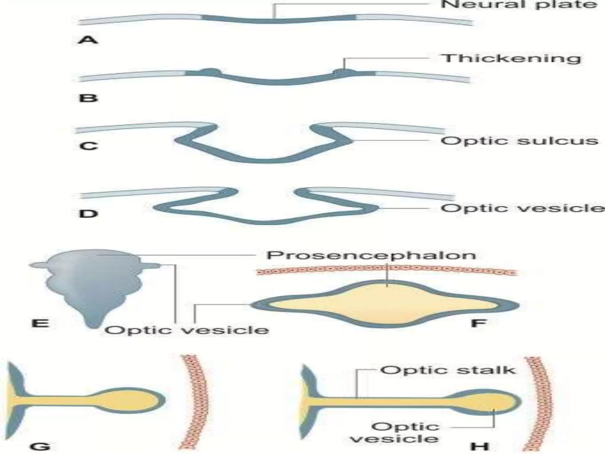 Embryology of human eye | PPTX | Eye and Vision Conditions | Diseases ...