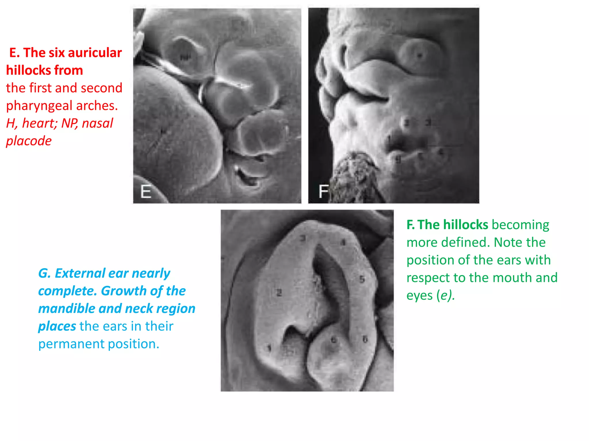 embryology of inner ear.pptx