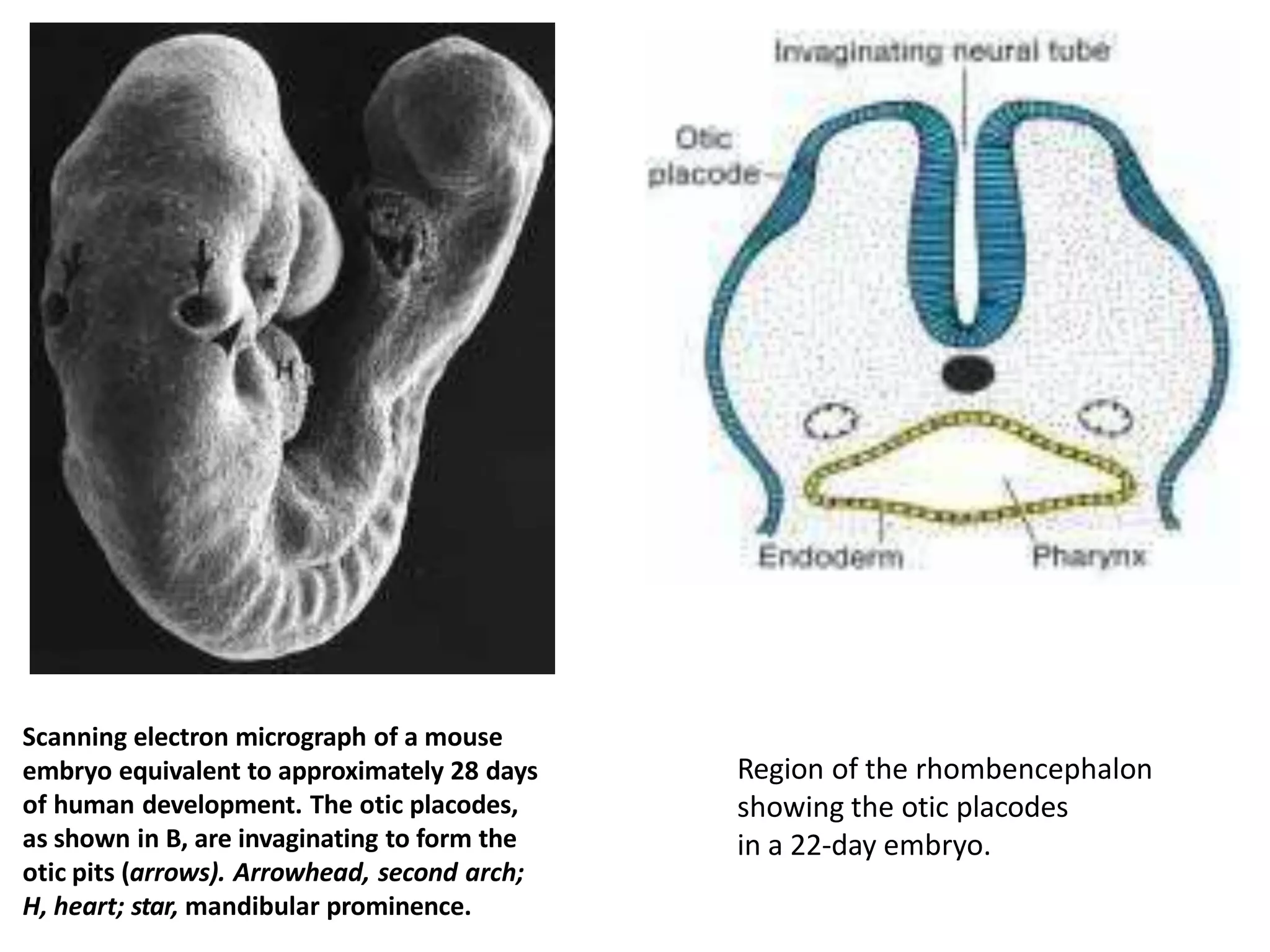 embryology of inner ear.pptx