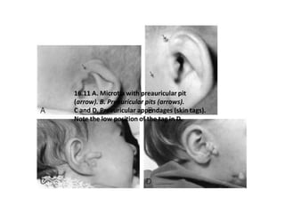 embryology of inner ear.pptx | Free Download