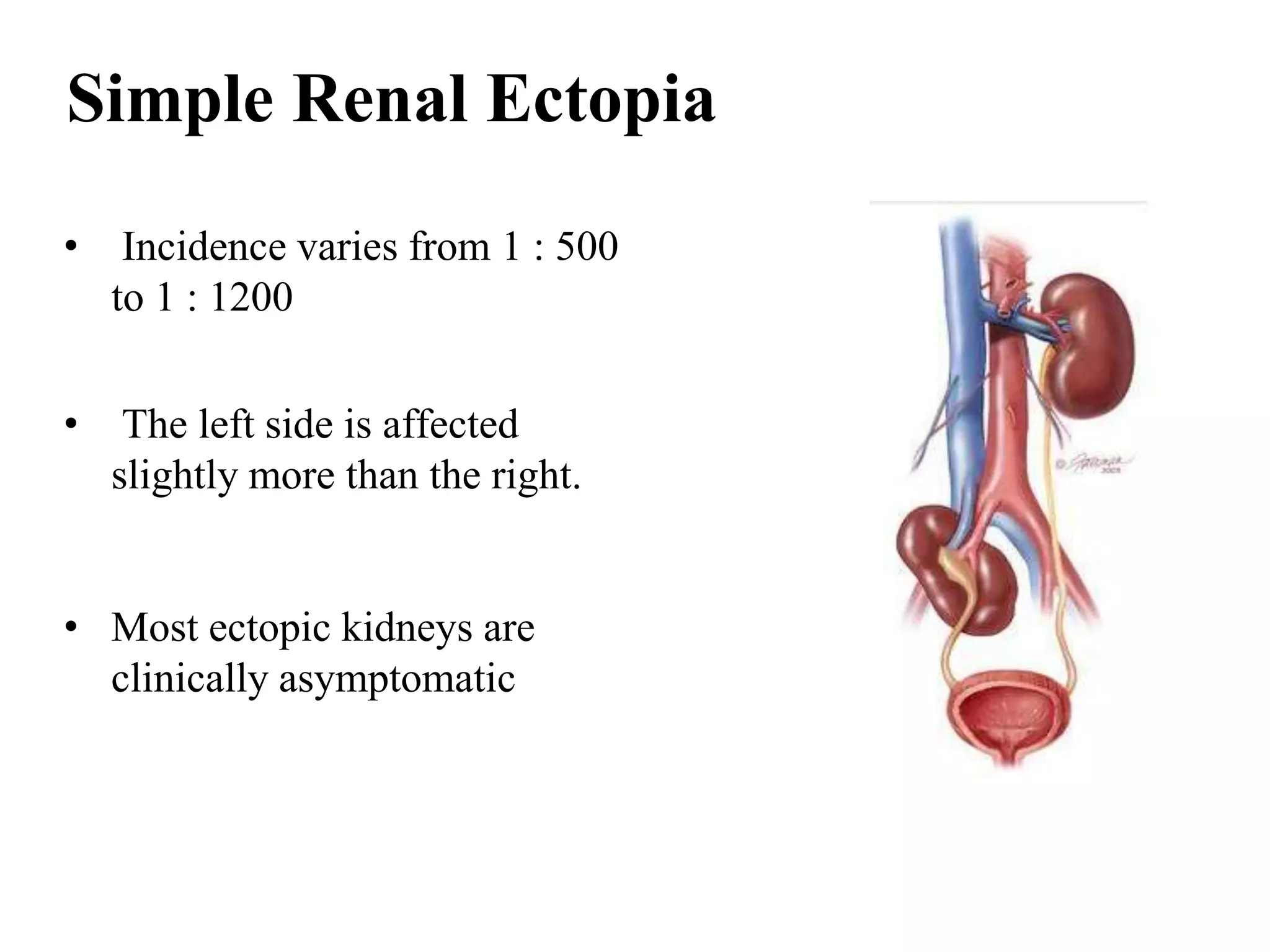 Embryology of kidney | PPTX