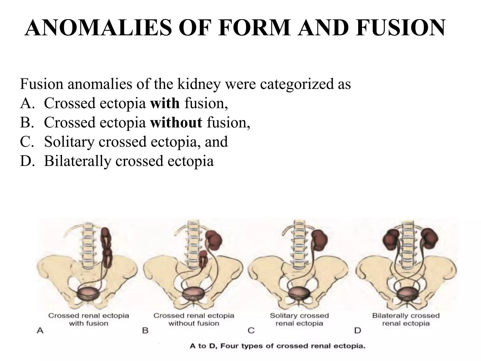 Embryology of kidney | PPTX