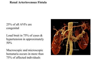 Embryology of kidney | PPTX